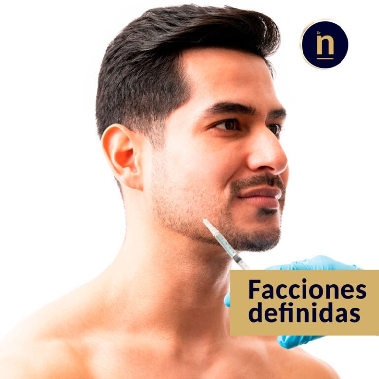 Reestructuración del ángulo mandibular - Doctor Nelson Cáceres